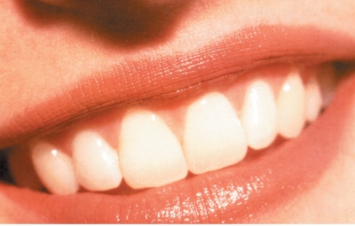 efficacia-del-colluttorio-foto 5306 - MedicinaLive