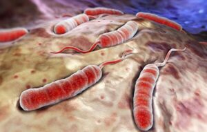 Colera, epidemia in Nigeria - MedicinaLive